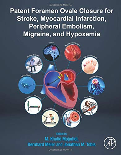 [PDF] Patent Foramen Ovale Closure for Stroke, Myocardial Infarction ...